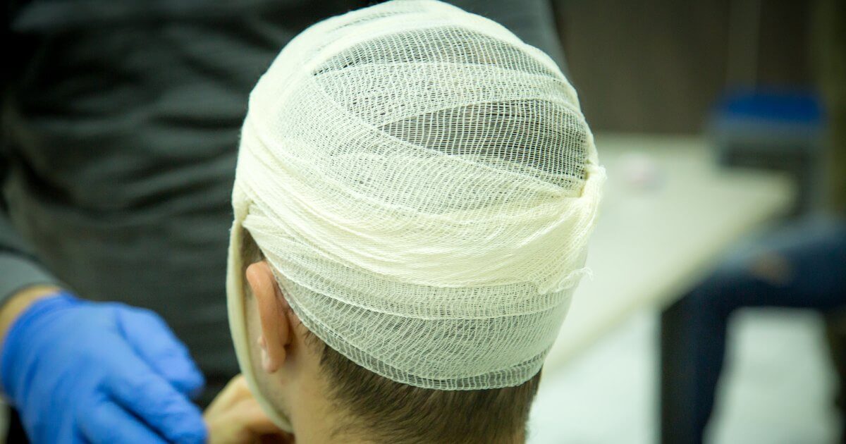 I Suffered a Head Injury in a Windsor Slip and Fall Accident
